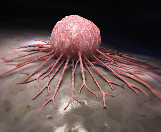 Tumor-Őr | Gyógyszer Nélkül